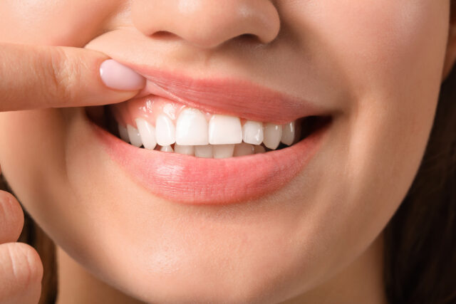 What Causes Itchy Gums? Understanding Triggers, Symptoms