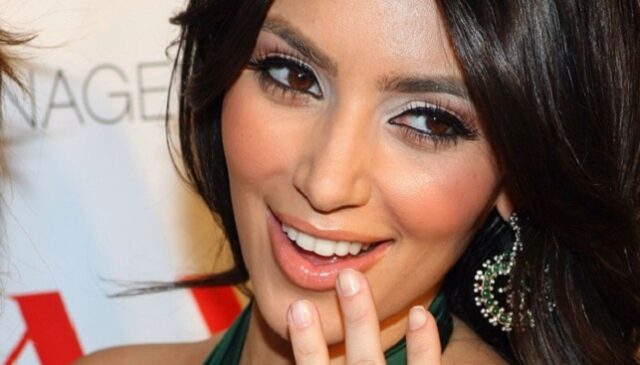 Kim Kardashian Teeth Before and After